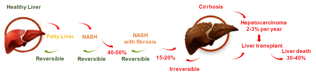 Non-alcoholic steatohepatitis (NASH) - Inventiva Pharma